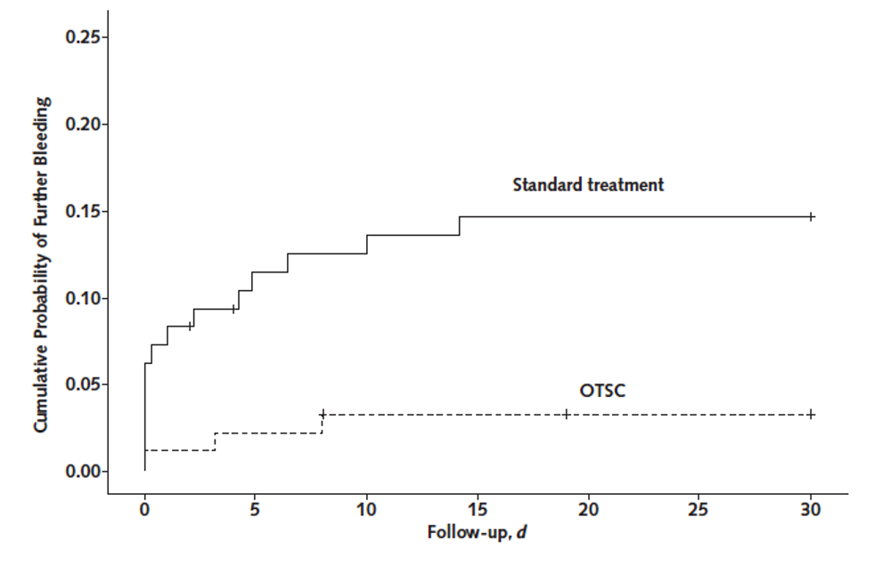 Over-the-Scope Clips Decrease Non-Variceal Upper GI Bleeding vs ...