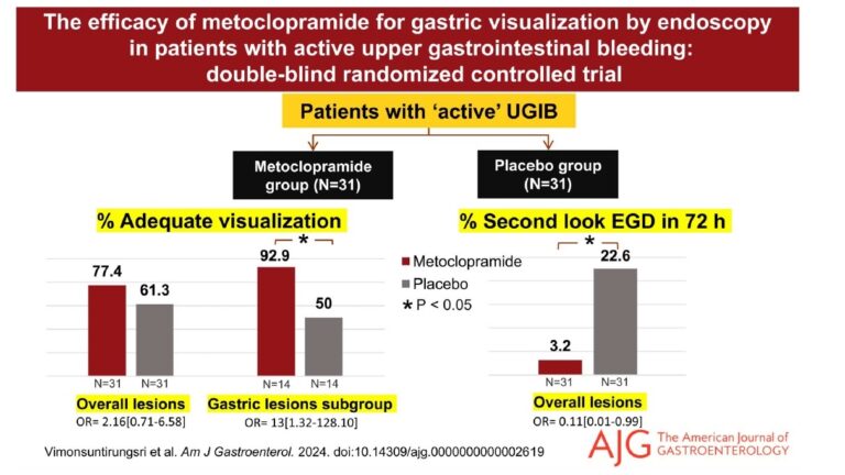 Can IV Metoclopramide Improve Endoscopic Visualization for Patients ...